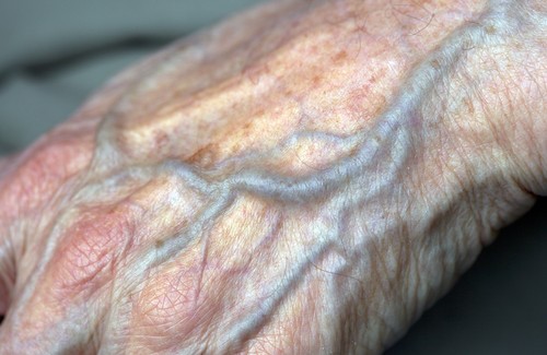 How Can I Improve Circulation in My Hands? - Step To Health