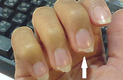 How to Prevent Nails from Breaking - Step To Health