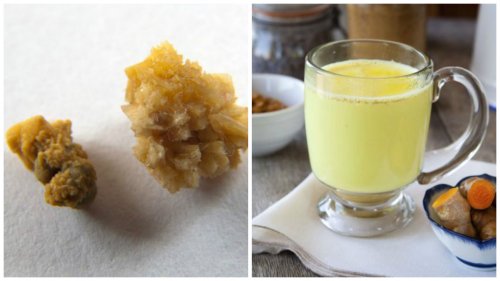 Combat Kidney Stones with Ginger and Turmeric Tea - Step To Health
