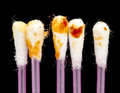 9 Tips to Clean Ears Safely and Quickly - Step To Health