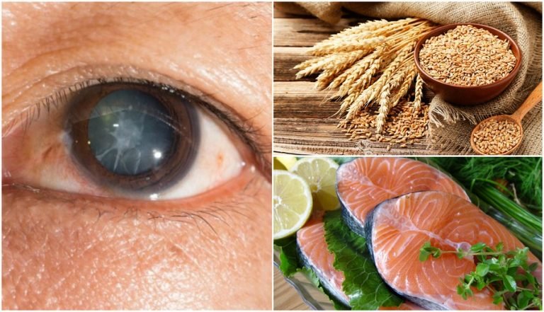 Reduce the Risk of Cataracts by Eating These 7 Foods - Step To Health