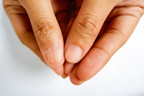 Why Are There Ridges on My Nails and How Do I Get Rid of Them? - Step ...