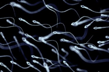 Necrozoospermia: cause of sperm death